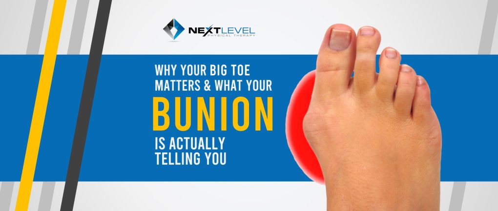 Why Your Big Toe Matters & What Your Bunion Is Actually Telling You ...